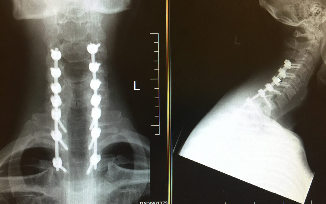 Areas of Practice_Specific Diagnosis - Neurocore Physiotherapy and ...